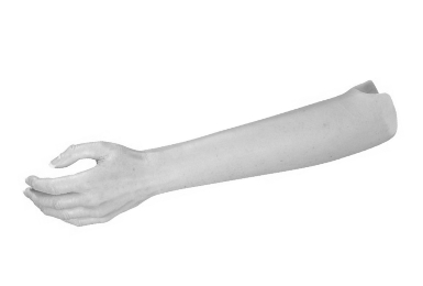 Upper Extremity